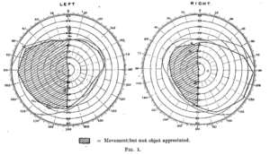 Seeing the movement: our visual brain at work | neurokunst